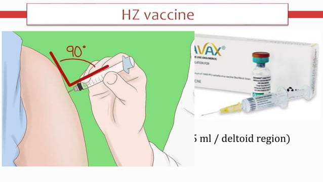 6 vb lesions (2) vzv + ramsy hunty s | PPTX