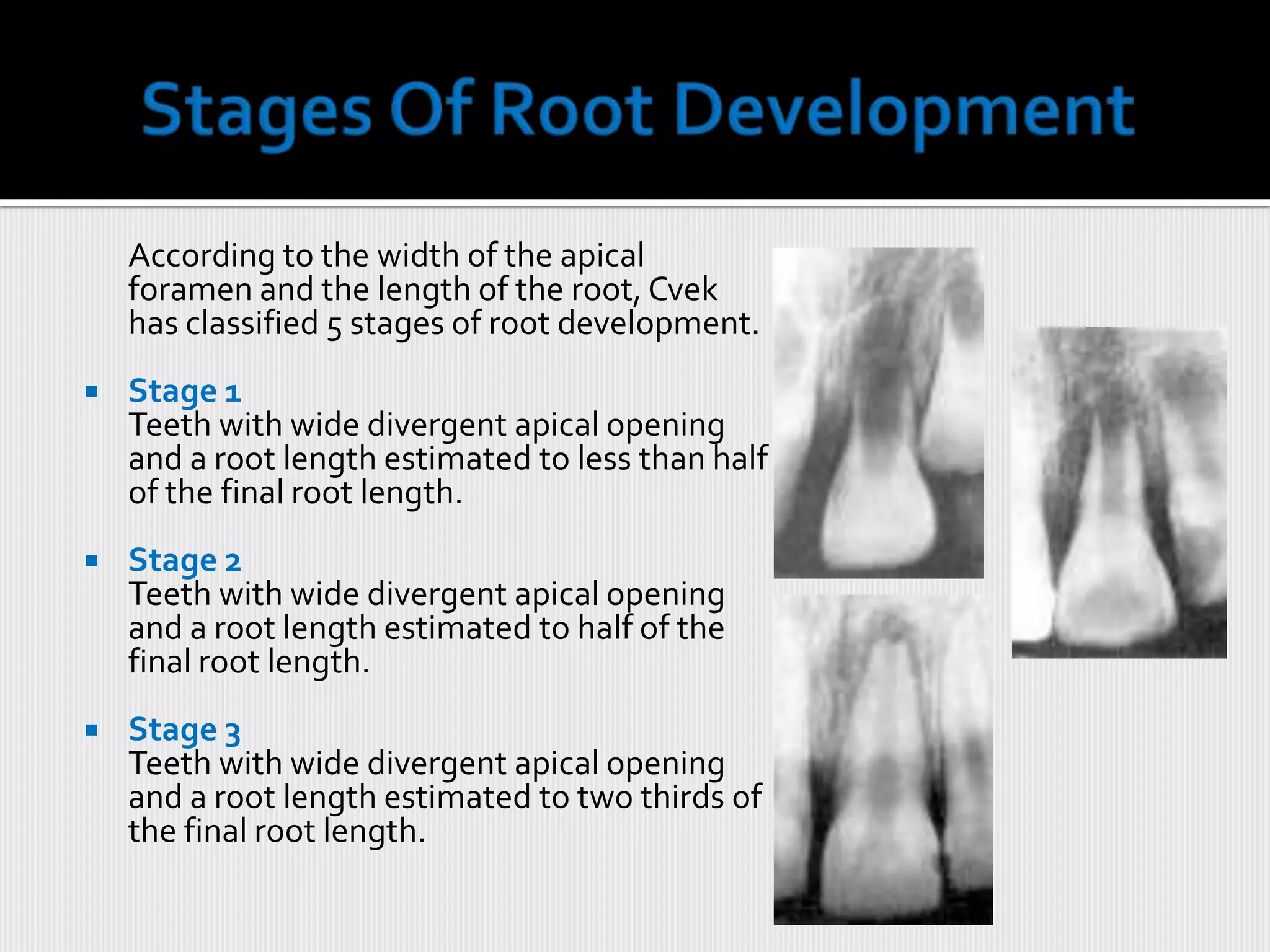 young permanent tooth | PPTX
