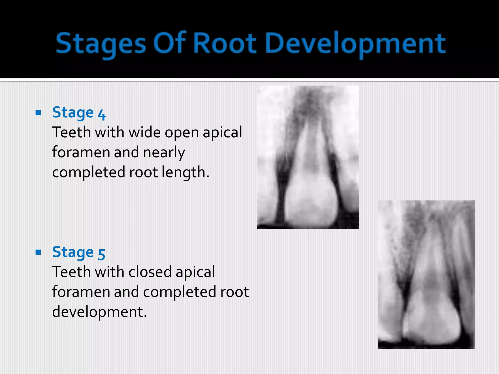 young permanent tooth | PPTX