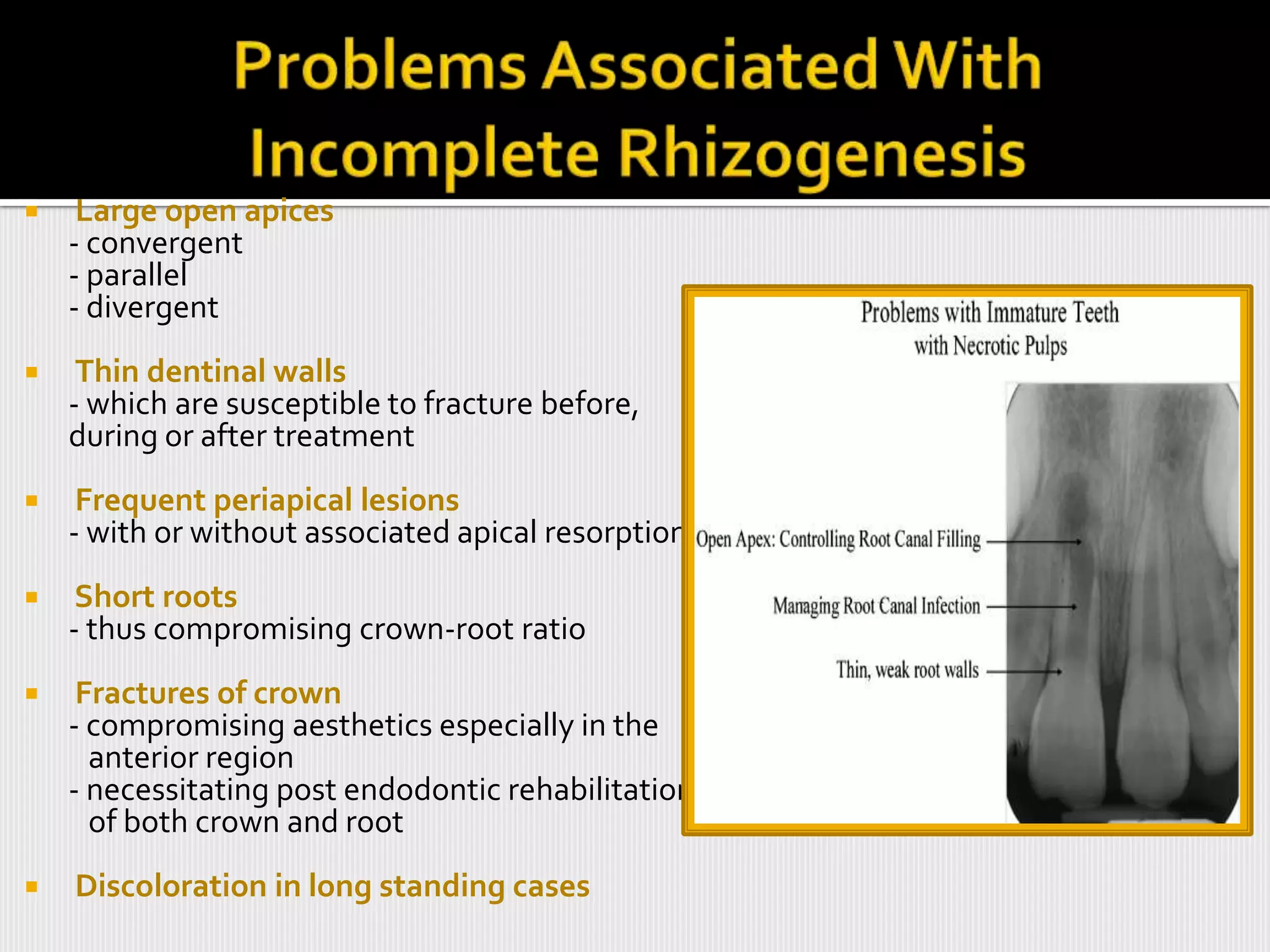 young permanent tooth | PPTX