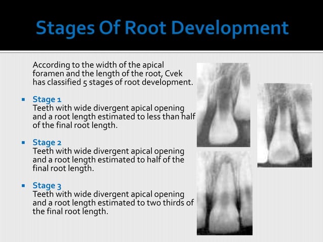 young permanent tooth | PPTX | Dental Health | Diseases and Conditions