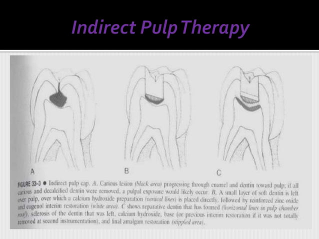 young permanent tooth | PPTX | Dental Health | Diseases and Conditions