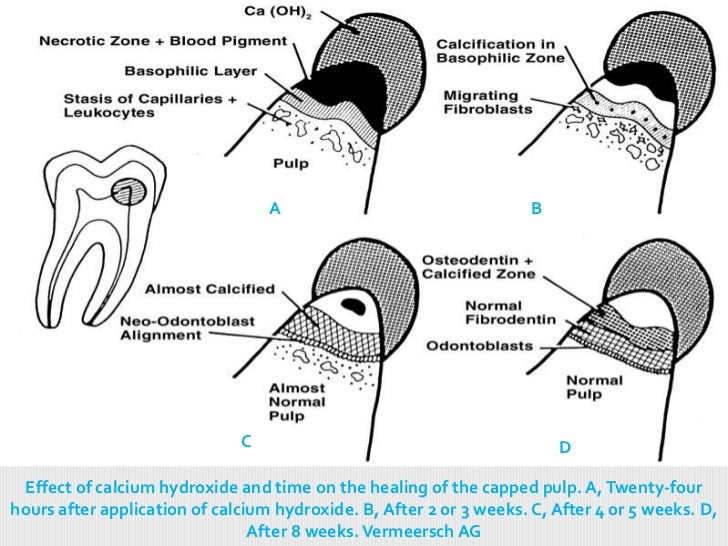 young permanent tooth