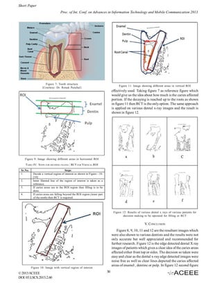 ISEF based Identification of Dental Caries in Decayed Tooth | PDF