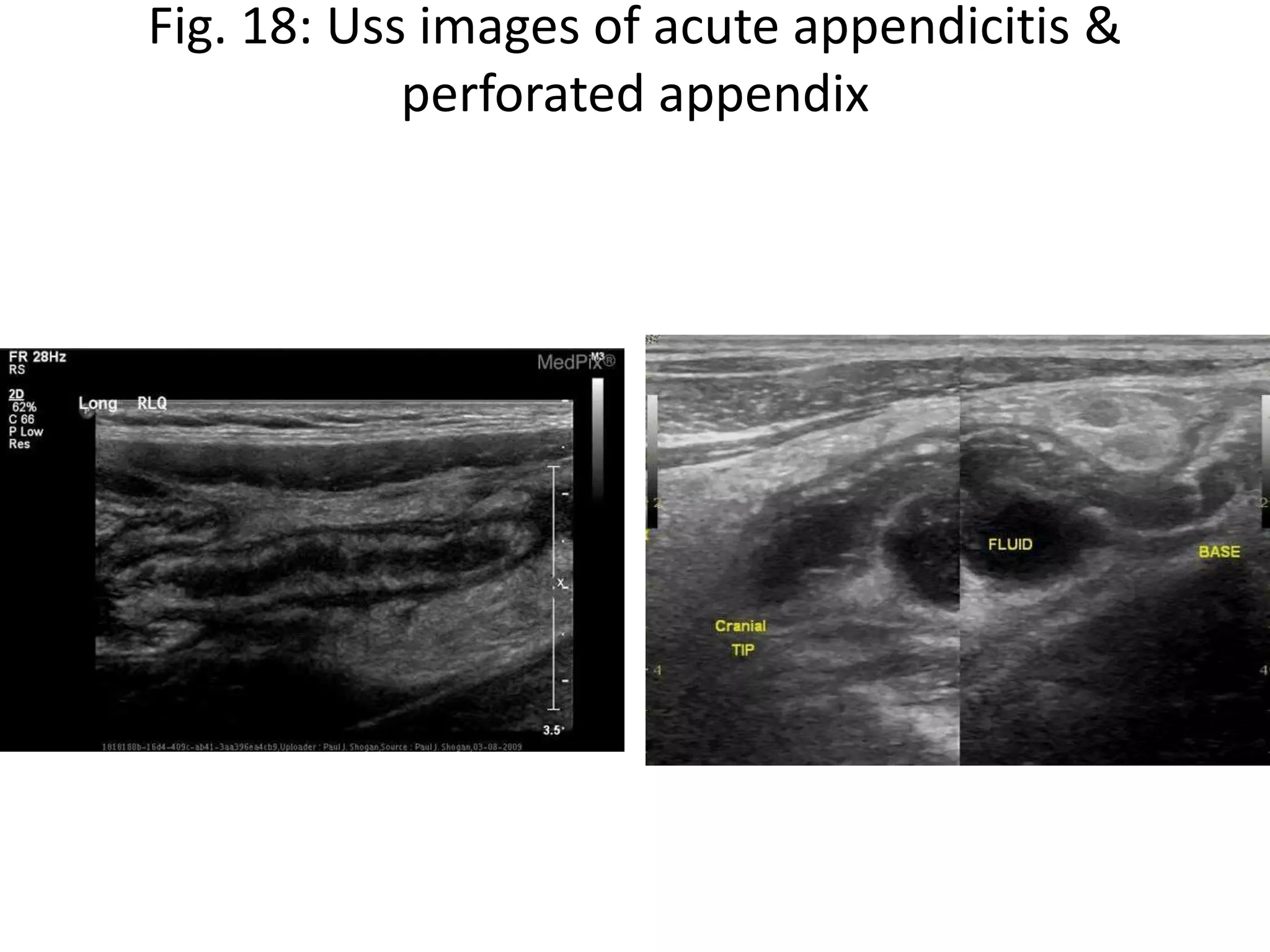 600L MBBS Radiology TUTORIAL 2022.pptx
