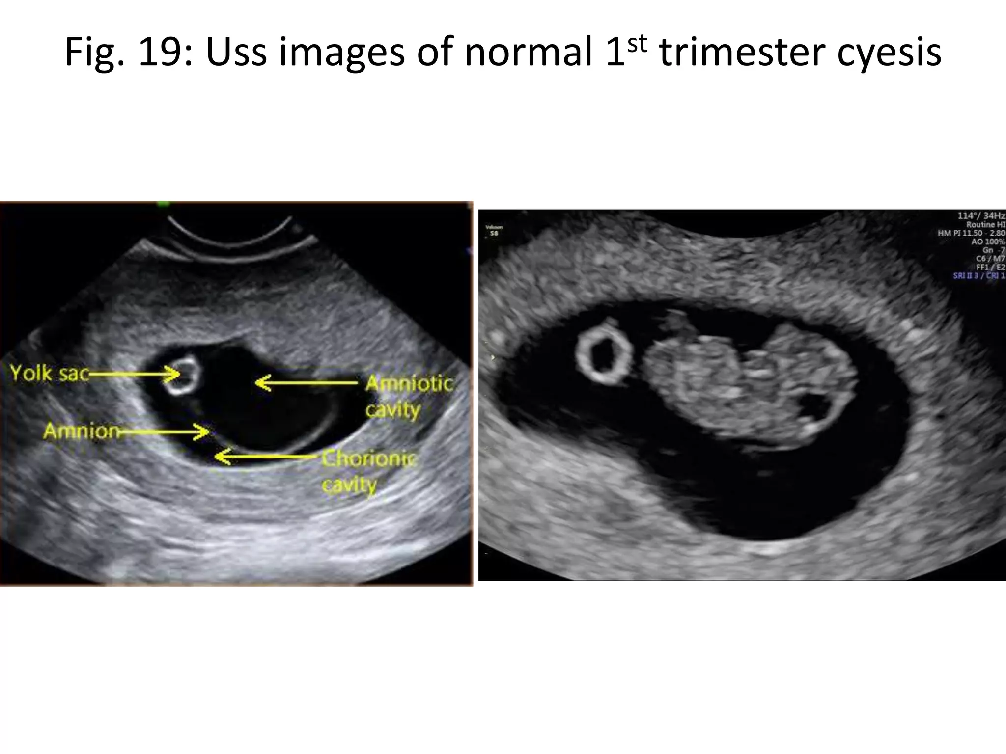 600L MBBS Radiology TUTORIAL 2022.pptx