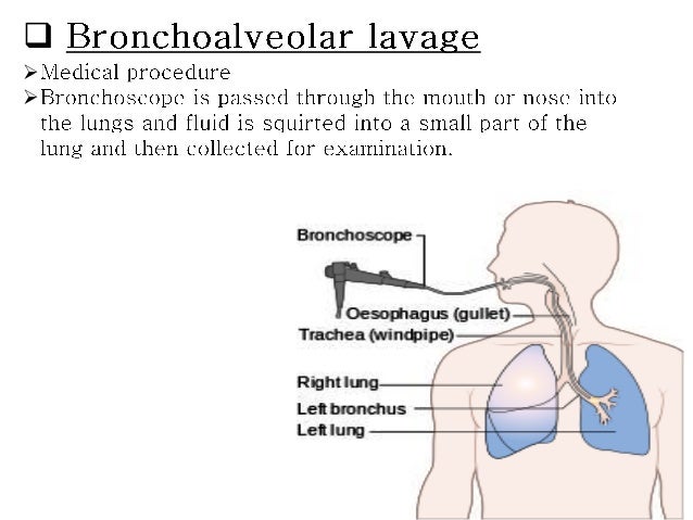 lab diagnosis of pneumoniae final slide