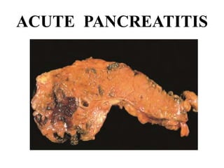 Acute Pancreatitis Gross