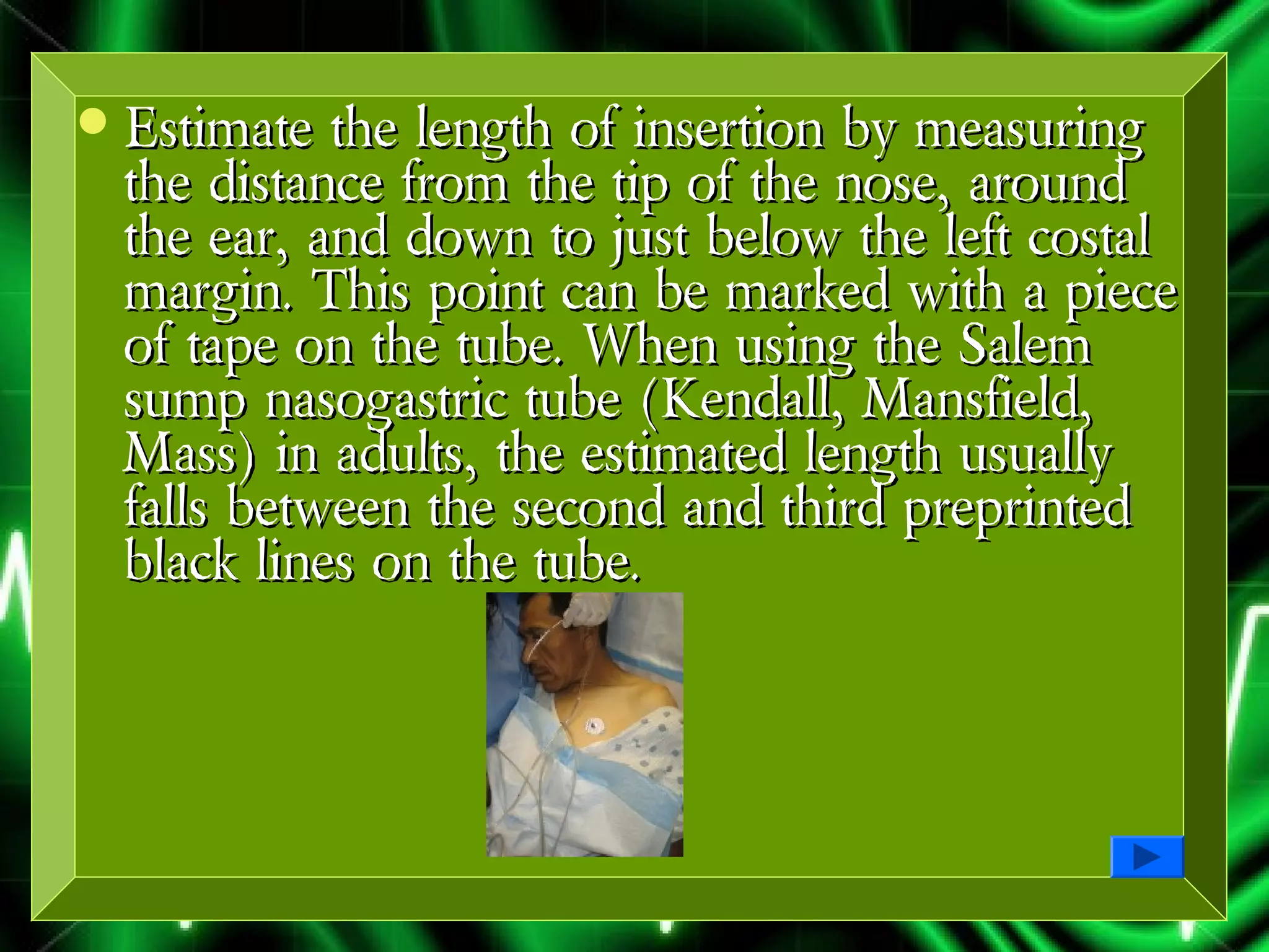 6080986 nasogastric-tube-insertion | PPT
