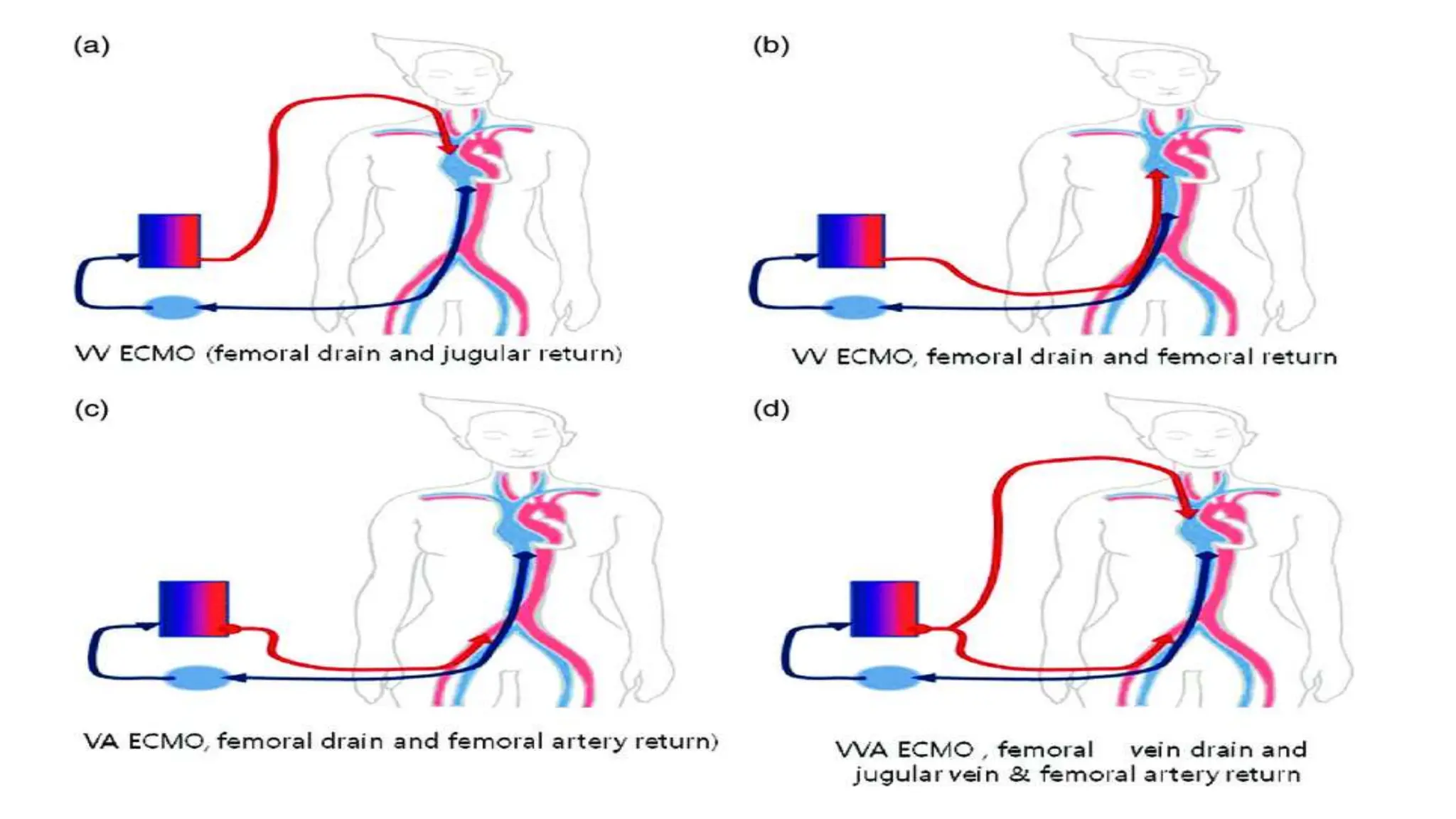 608770180-ECHMO.pptx detailed explanation | PPTX