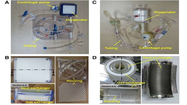 608770180-ECHMO.pptx detailed explanation | PPTX | Lung and Respiratory ...
