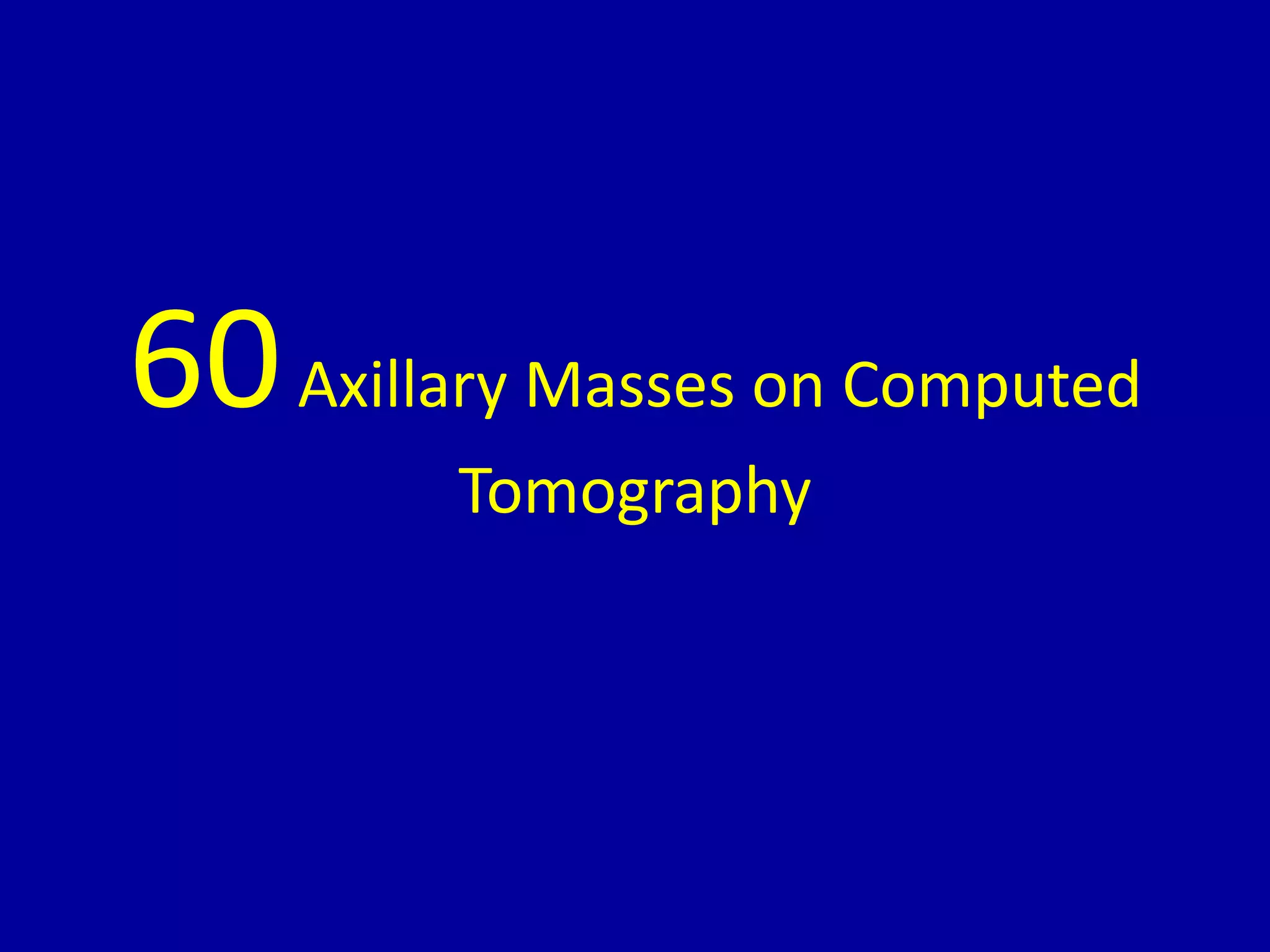 60 axillary masses on computed tomography | PPTX