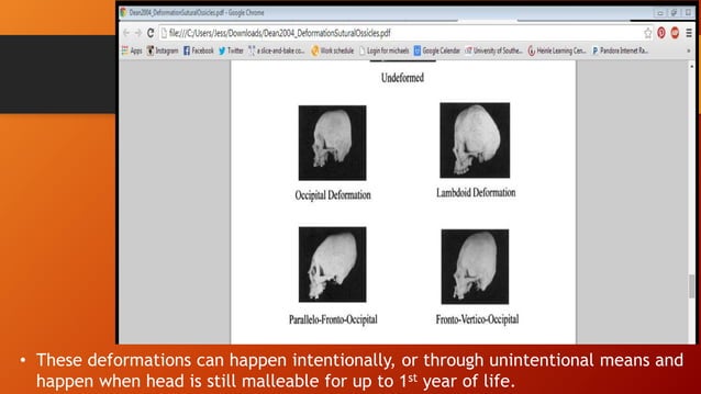 Cranial Deformations of Native Peoples of North America | PPTX | Bone ...
