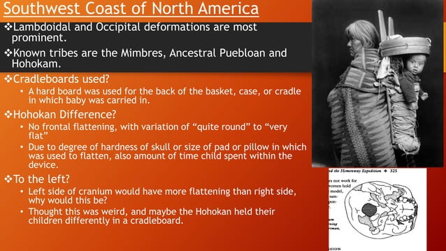 Cranial Deformations of Native Peoples of North America | PPTX | Bone ...