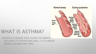 Asthma Project Spr 16' | PPT
