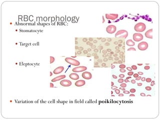 61227_Examine peripheral blood film.pdf
