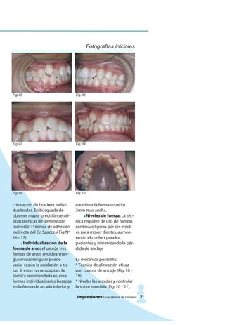 61459674 imp1-ortodoncia-mbt | PDF