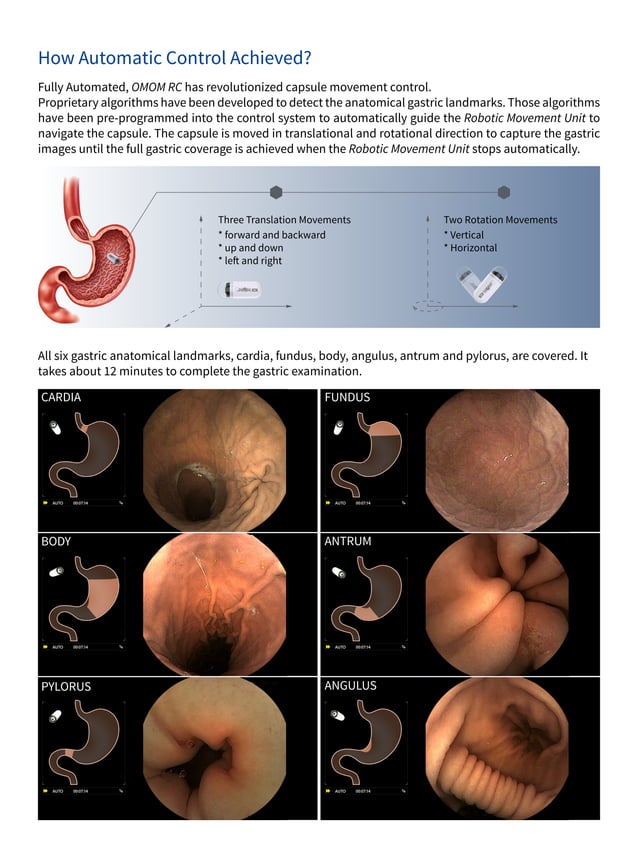 robotic capsule endoscopy | PDF