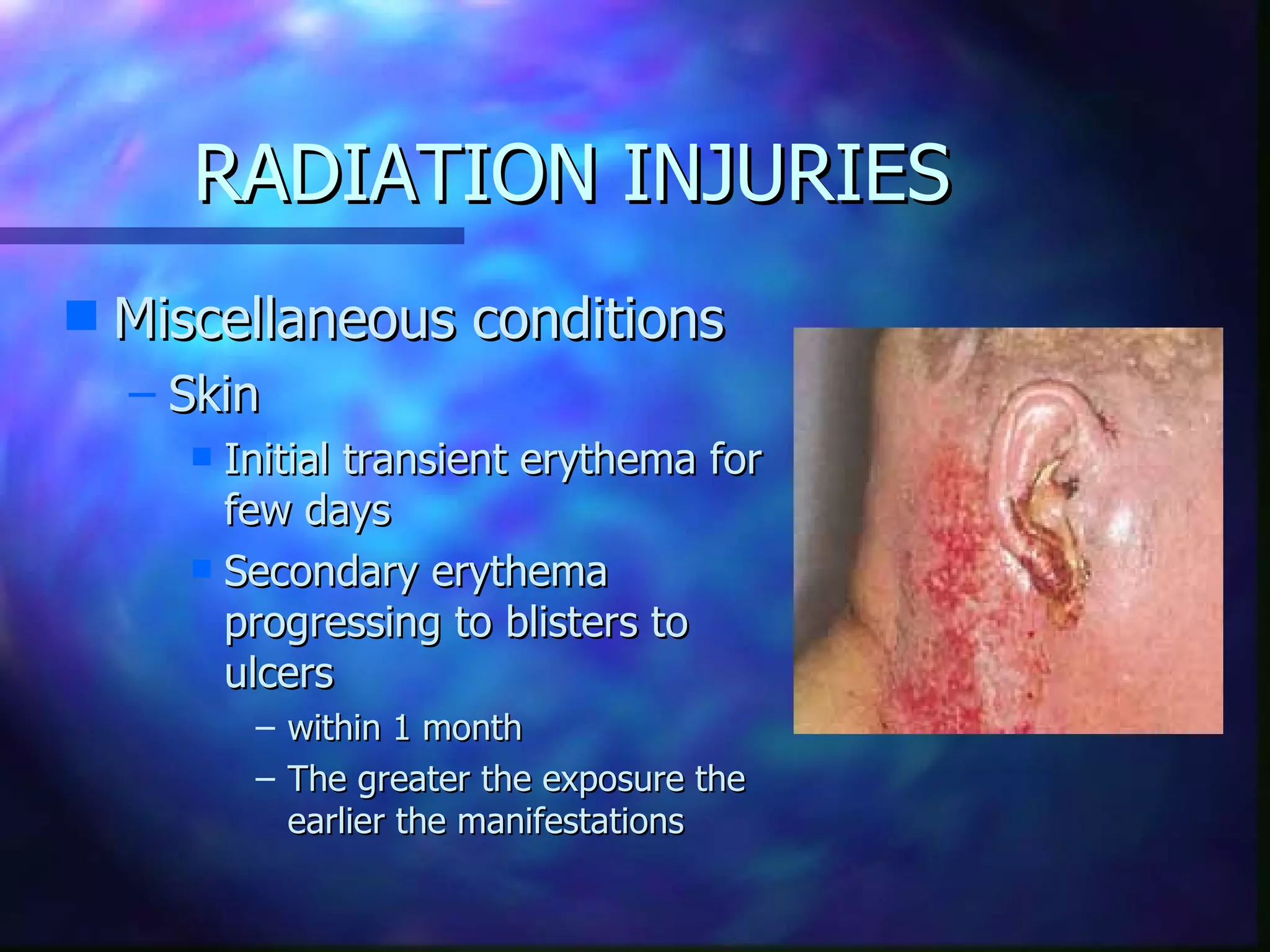 radiation injury | PPT