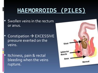 form 4 Biology chap6 pt6 | PPT