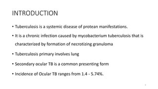 620_Ocular_Tuberculosis.pptx