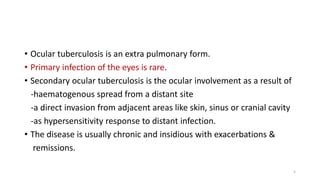 620_Ocular_Tuberculosis.pptx