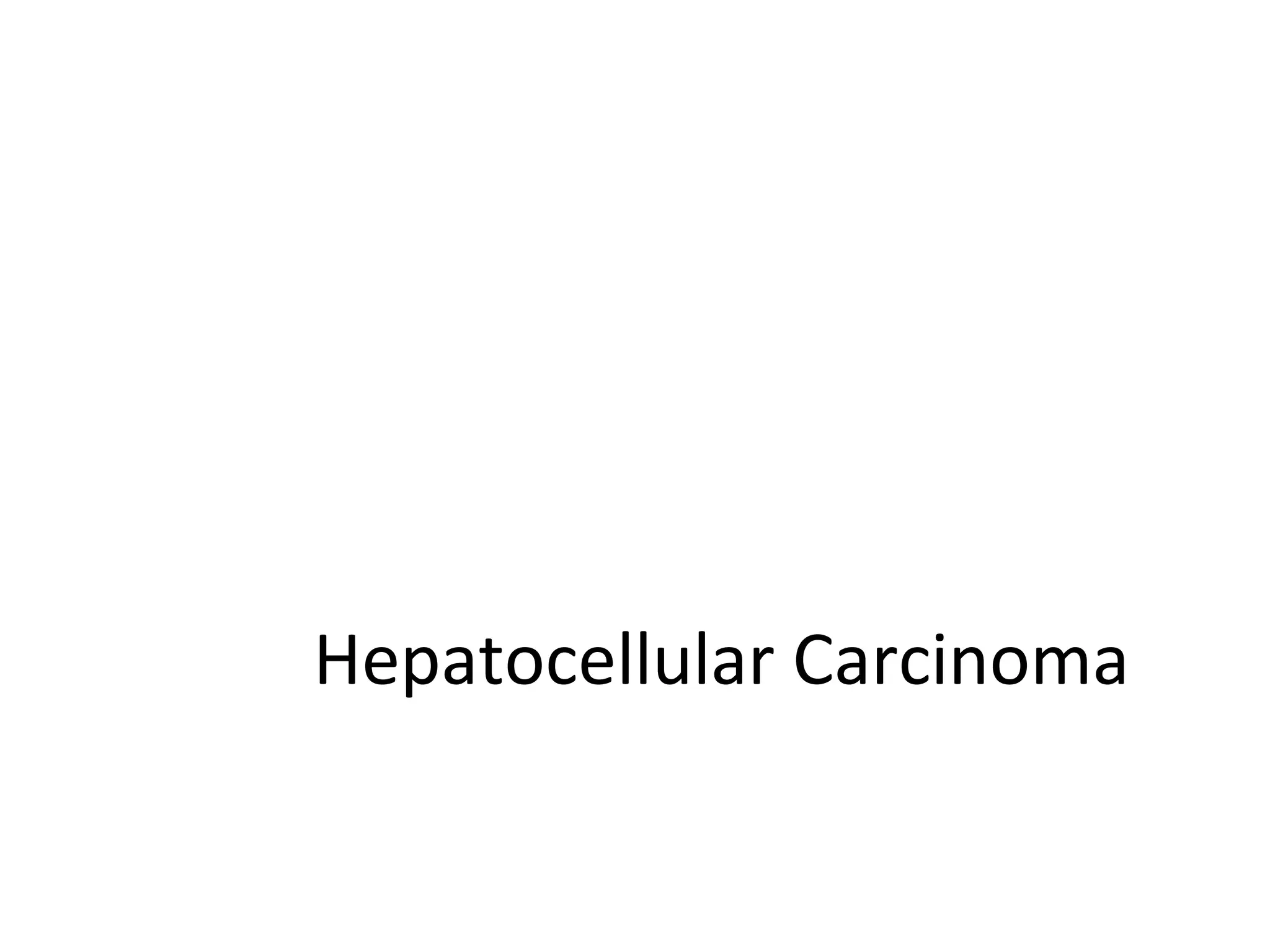 hepatocellular carcinoma | PPT