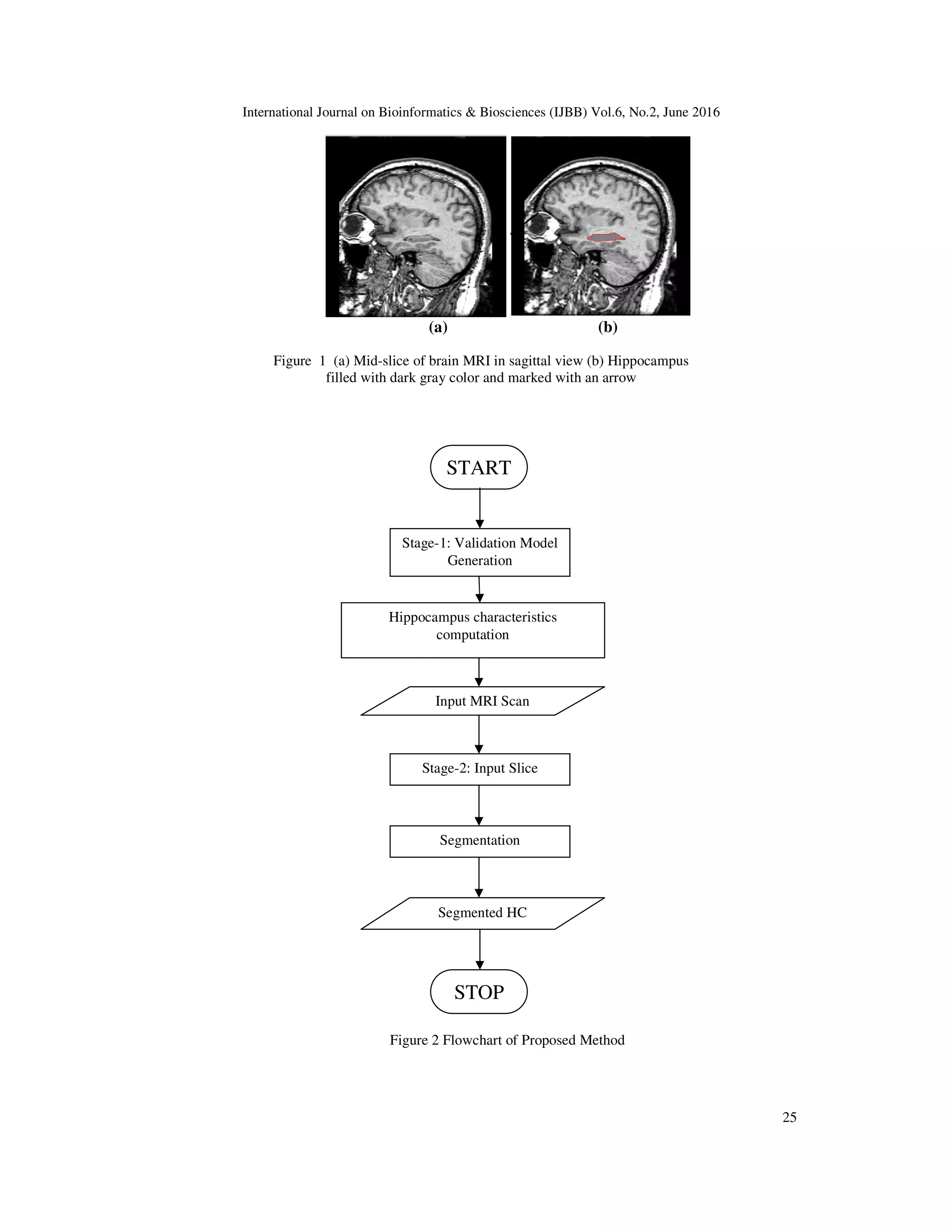 A SIMPLE APPROACH FOR RELATIVELY AUTOMATED HIPPOCAMPUS SEGMENTATION FROM SAGITTAL VIEW OF BRAIN ...