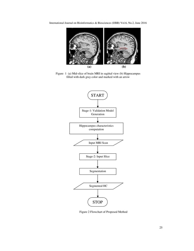 A SIMPLE APPROACH FOR RELATIVELY AUTOMATED HIPPOCAMPUS SEGMENTATION FROM SAGITTAL VIEW OF BRAIN ...