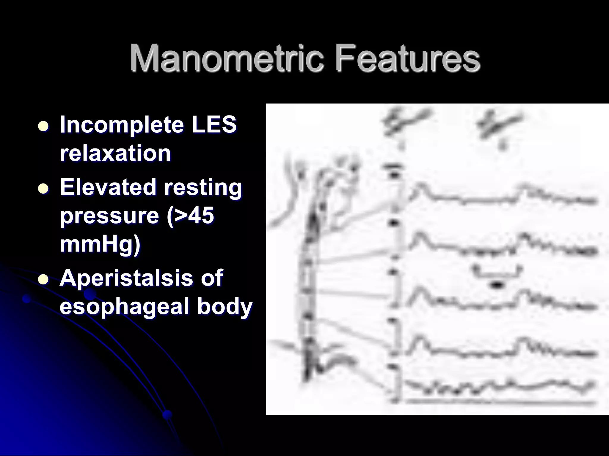 62624_Esophageal Disorders (5th Year).ppt