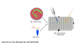 The MALDI-TOF application in diagnostic of microbial agents of ...