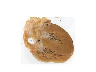 Cardiovascular ospe practical images | PPT