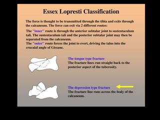 Radiology Rounds: 62 year old male with pain after fall | PPT