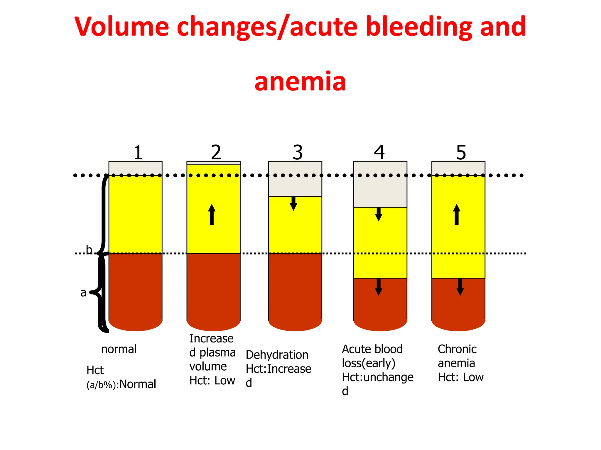 Medical surgicalnursing-Anemia-ppt-Raafat-pptx.pptx