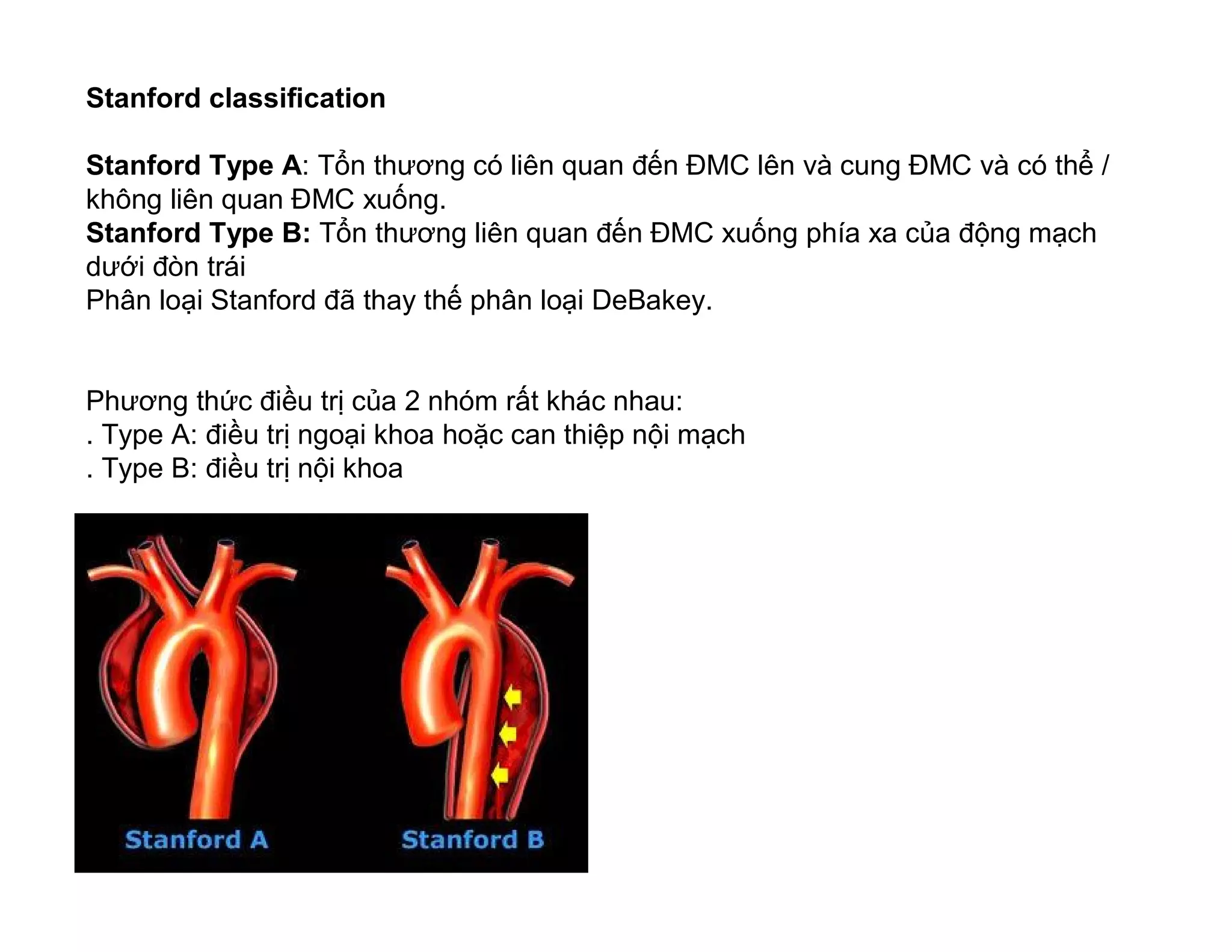 HỘI CHỨNG ĐỘNG MẠCH CHỦ CẤP(Acute Aortic Syndrome) | PDF
