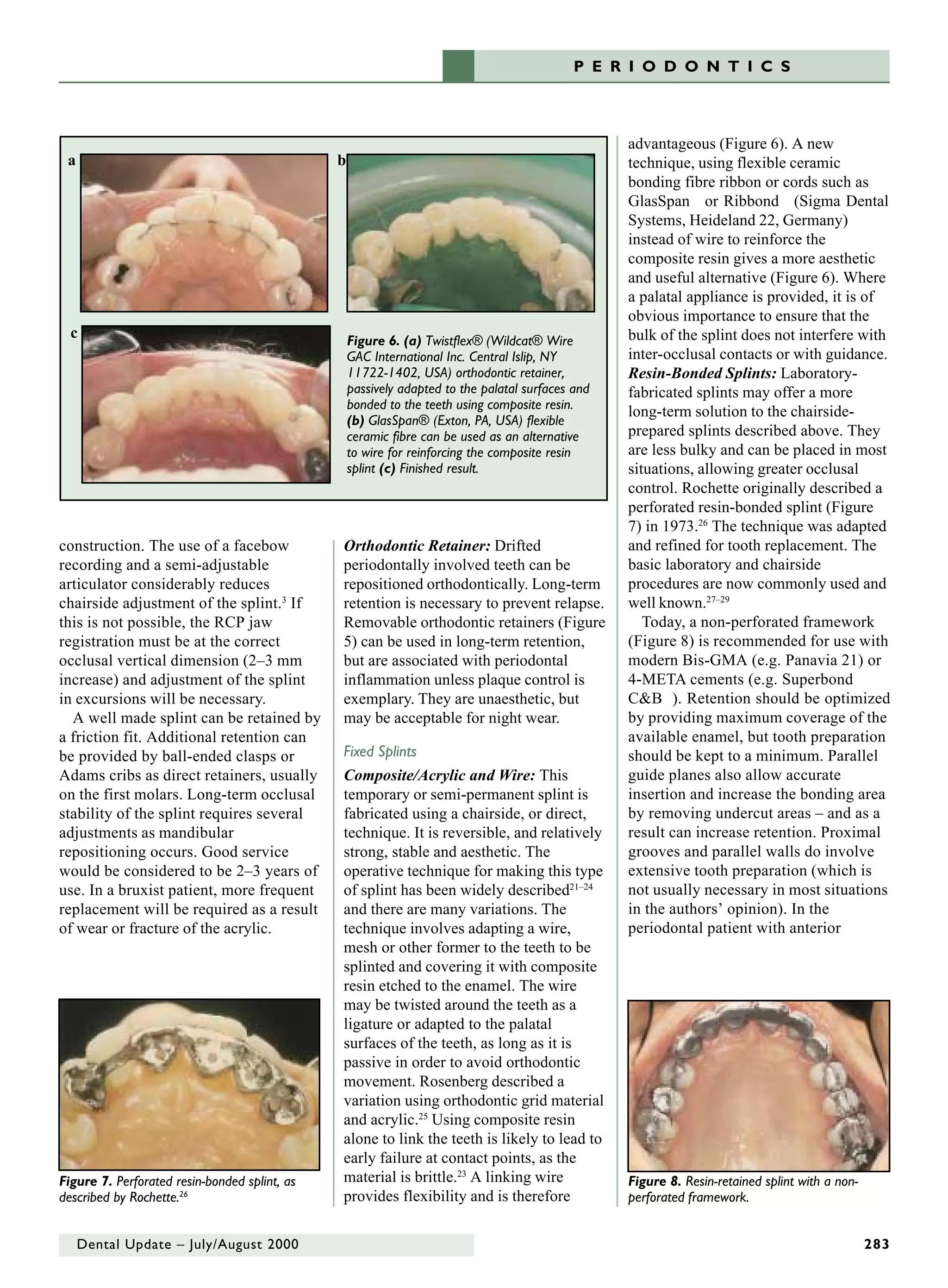 63668245 dental-update-periodontal-splinting-in-general-dental-practice ...