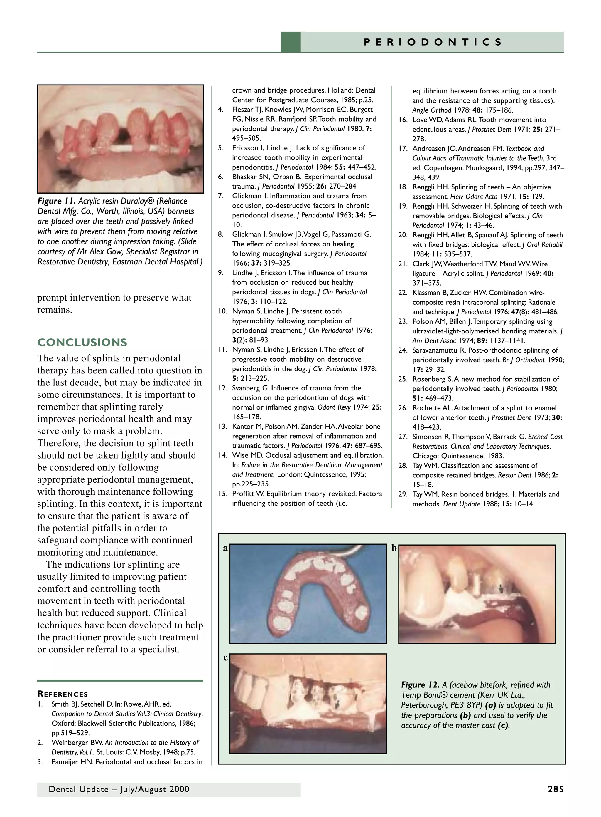 63668245 dental-update-periodontal-splinting-in-general-dental-practice ...