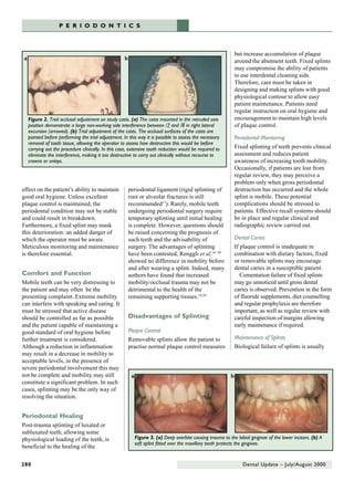 63668245 dental-update-periodontal-splinting-in-general-dental-practice ...