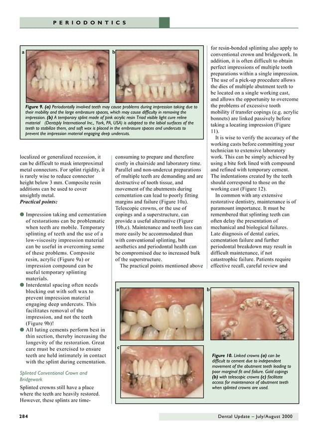 63668245 dental-update-periodontal-splinting-in-general-dental-practice ...