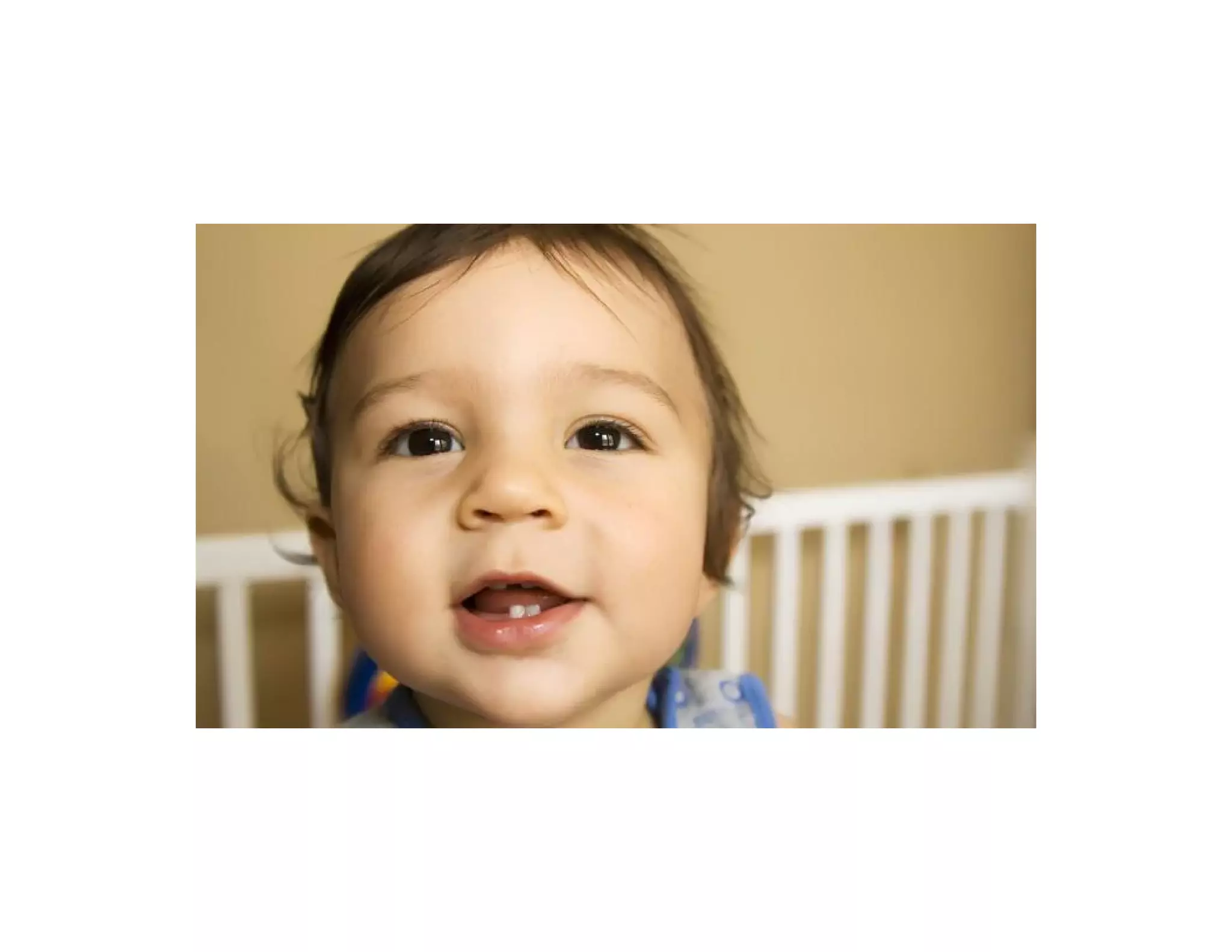 This is what causes crooked teeth in kids | PDF