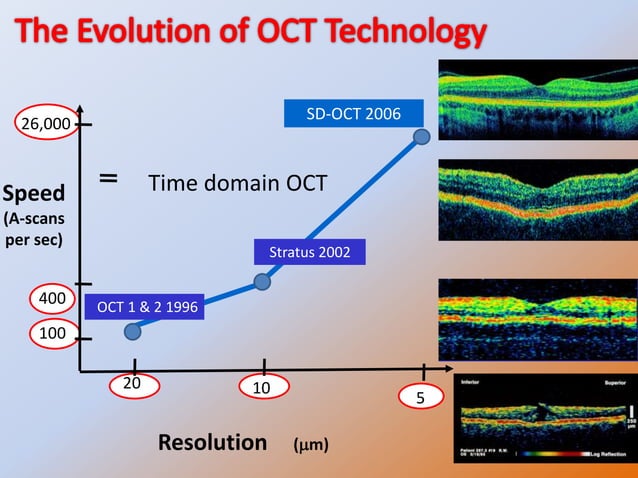 spectral domain OCT by Hala Fathi Hannot | PPT