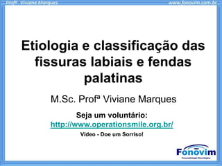 Aula-3--Etiologia-e-classificao-das-fissuras-labiais-e-fendas-palatinas.pdf
