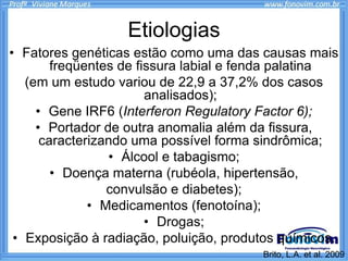 Aula-3--Etiologia-e-classificao-das-fissuras-labiais-e-fendas-palatinas.pdf