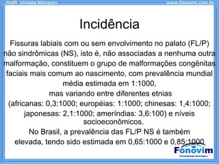 Aula-3--Etiologia-e-classificao-das-fissuras-labiais-e-fendas-palatinas.pdf