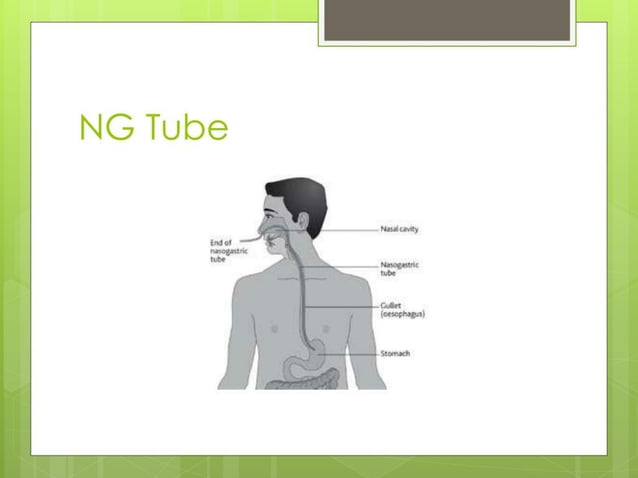catheters,et tubes, ng tubes and tubes.pptx
