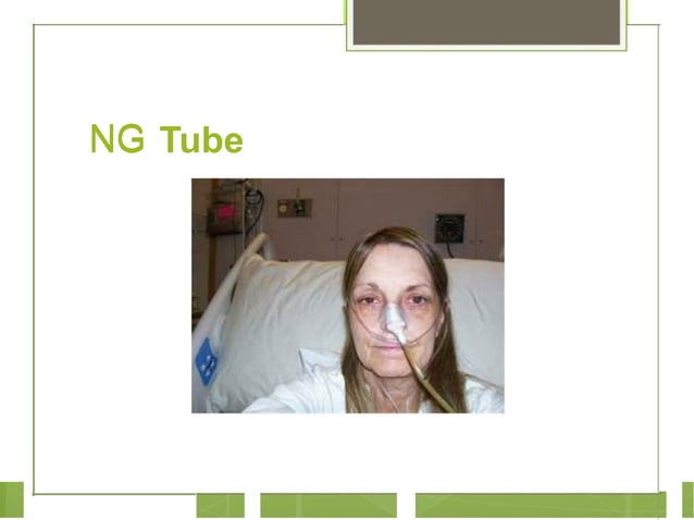 catheters,et tubes, ng tubes and tubes.pptx