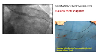 Lost Balloon - Manish Ramlall | PPTX