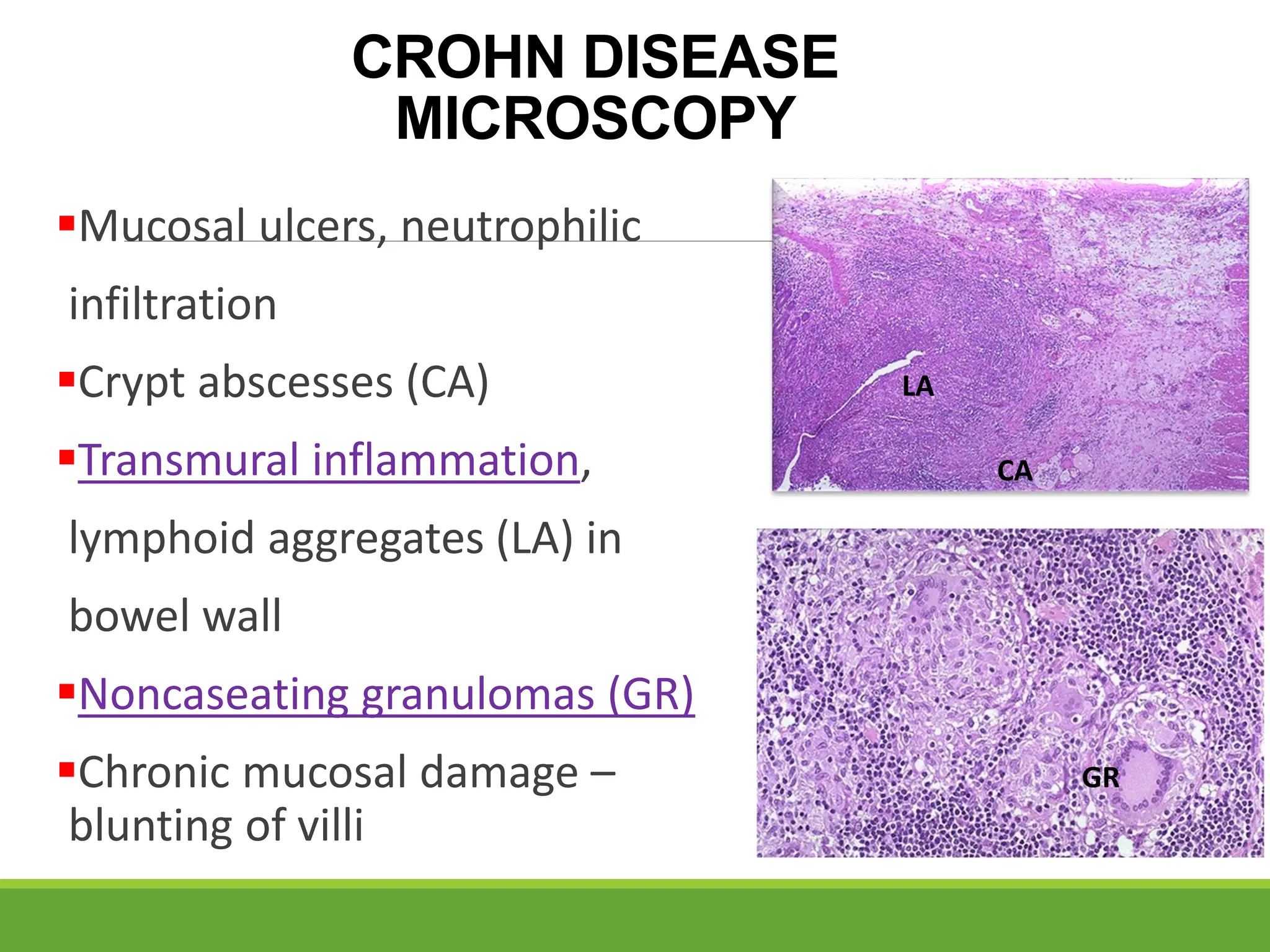 64-GIT 6.pdf peptic ulcer ND GASTRIC ULCer | PDF