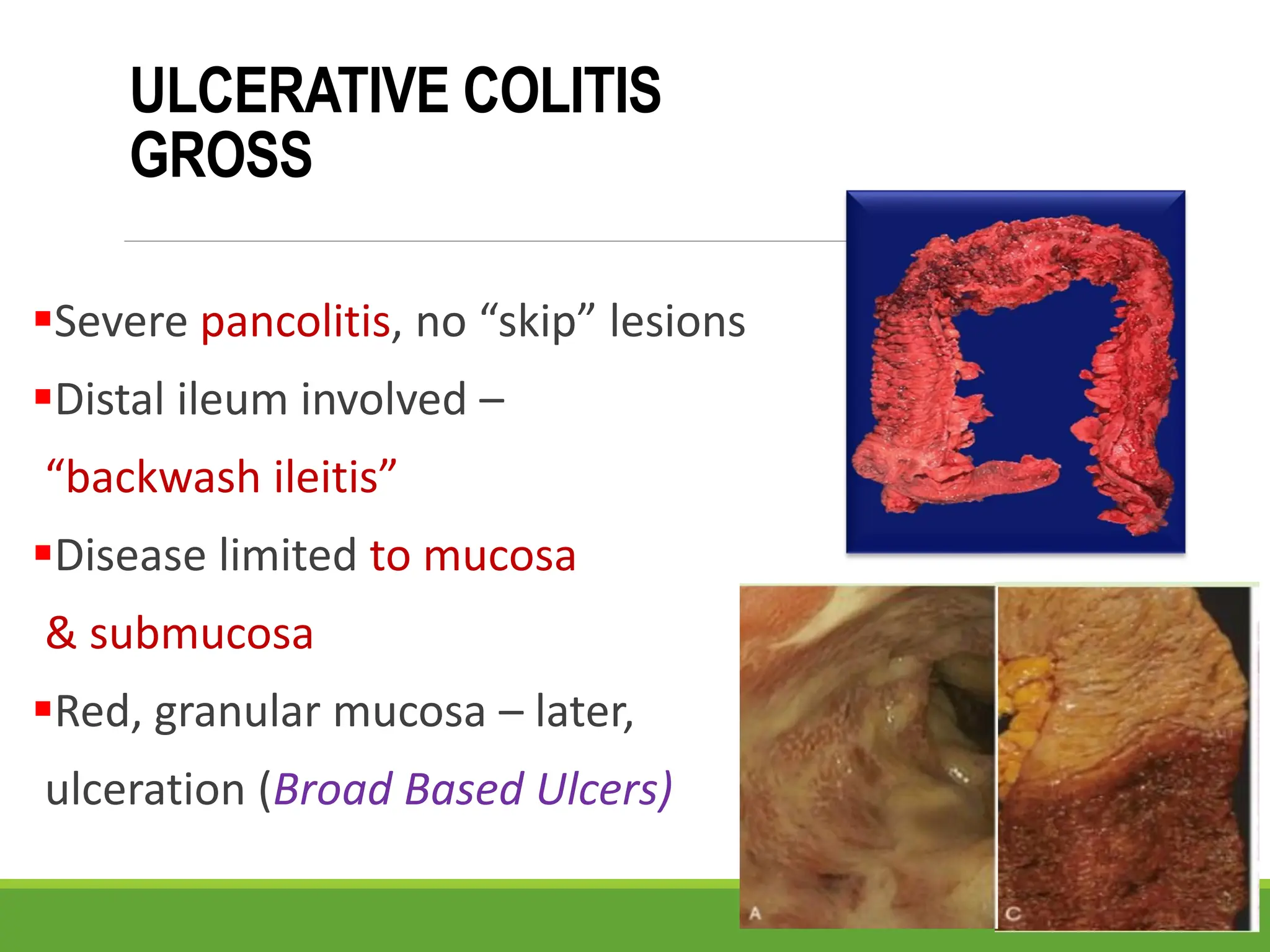 64-GIT 6.pdf peptic ulcer ND GASTRIC ULCer | PDF