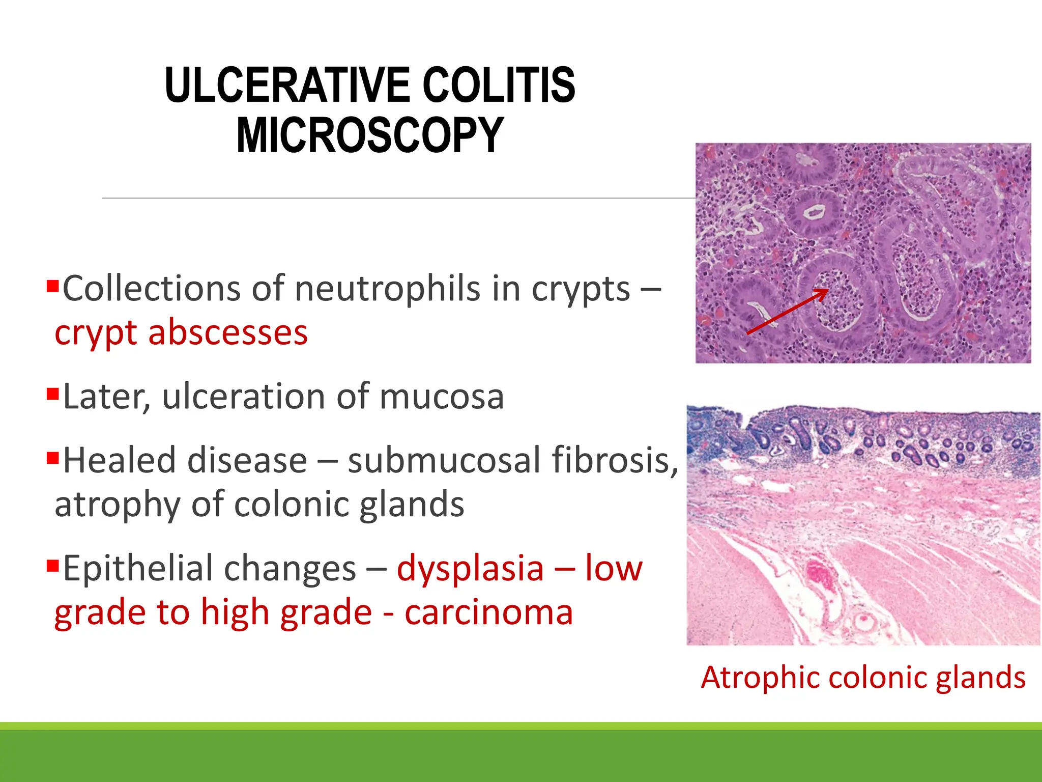 64-GIT 6.pdf peptic ulcer ND GASTRIC ULCer | PDF